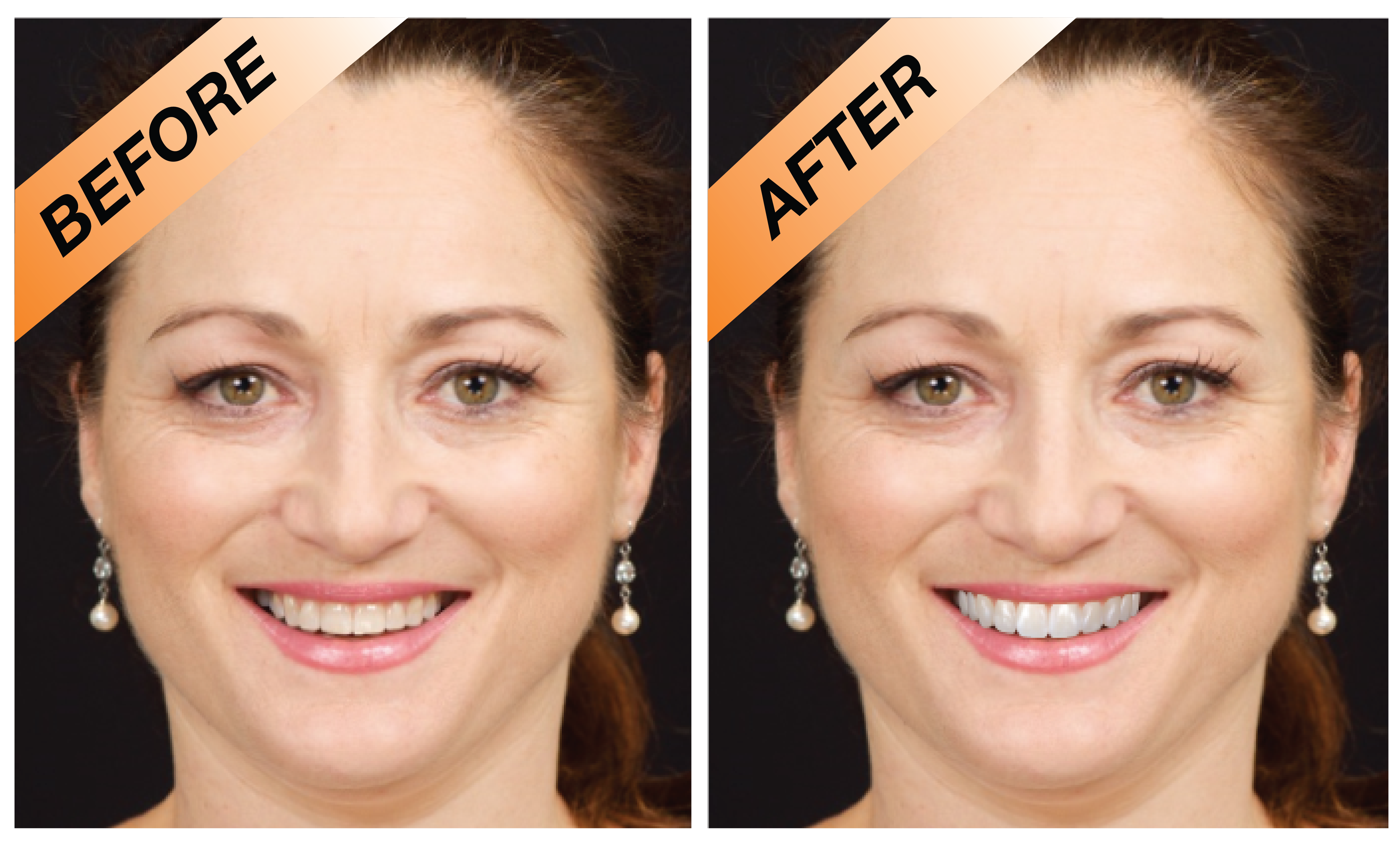 Digital Smile Design (DSD)